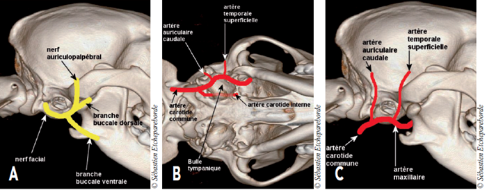 Conséquences d’une atrésie du conduit auditif externe